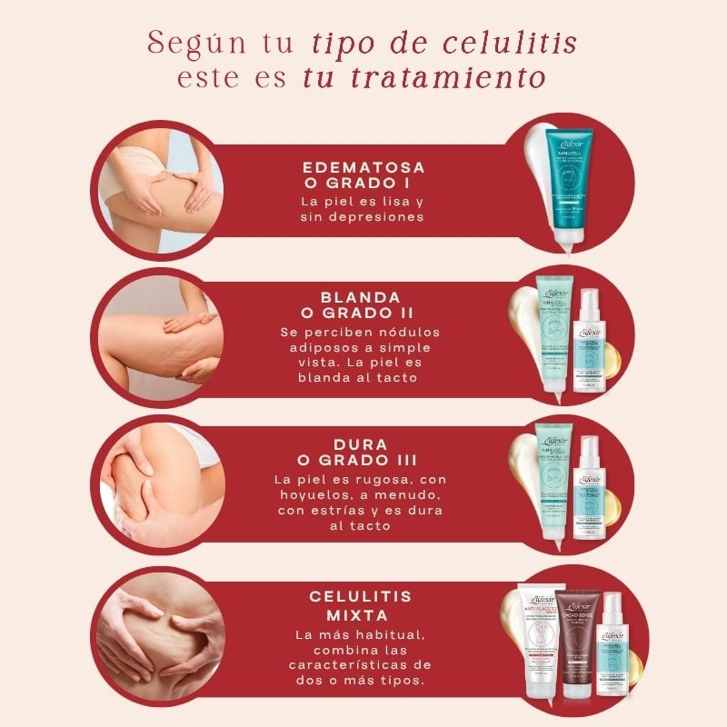 Tipos de celulitis: qué grados existen y cómo identificarlos